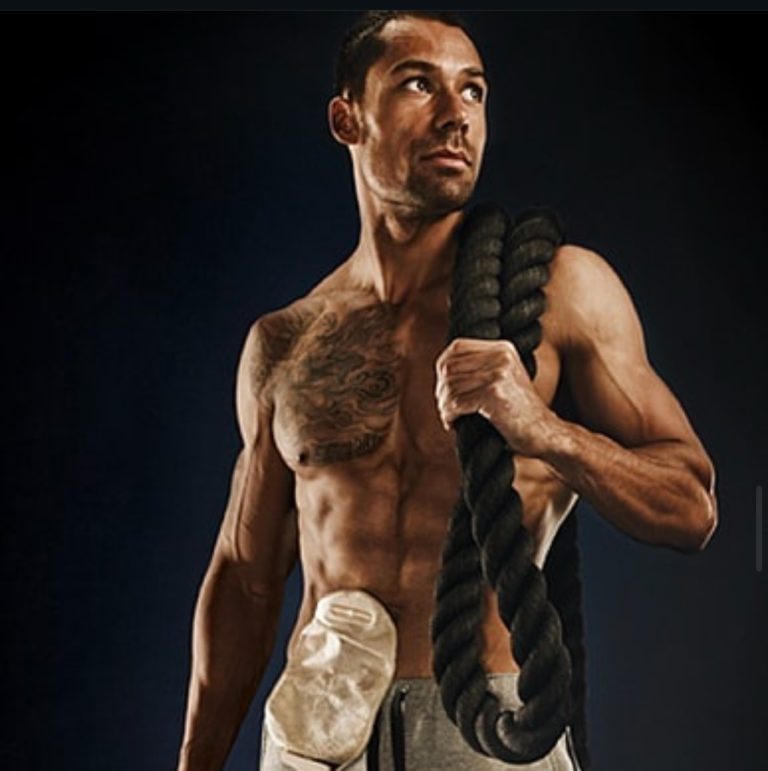 Celebrities with a stoma bag - Rhodes Pharma