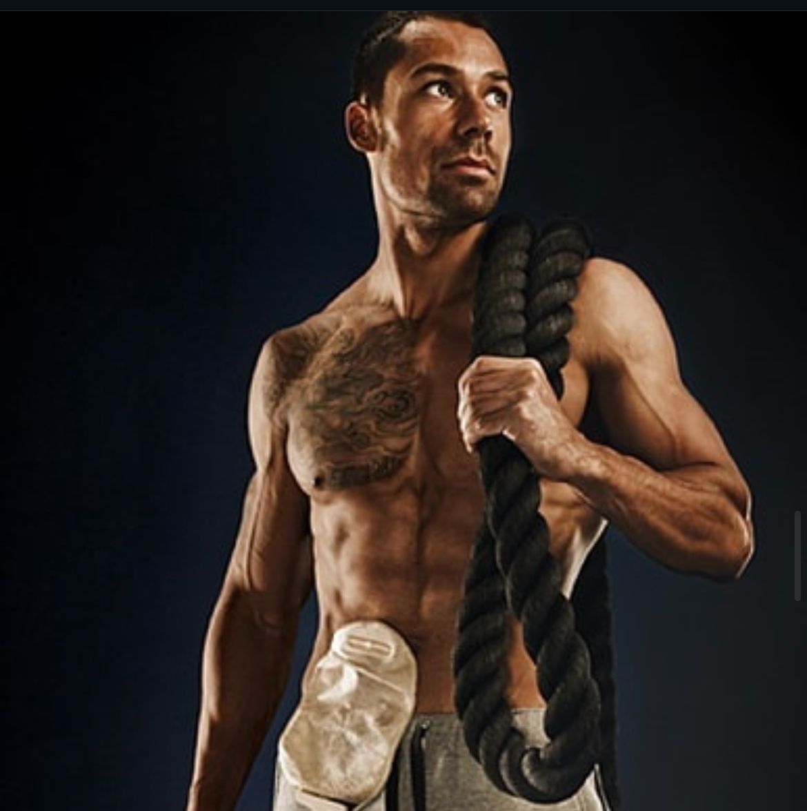 Celebrities with a stoma bag - StoCare - Rhodes Health