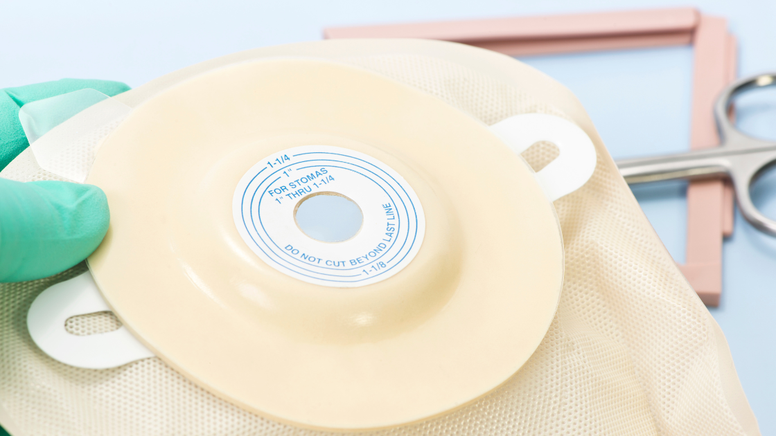 The ultimate guide to stoma bags - Rhodes Pharma