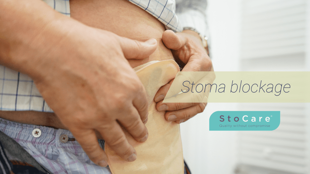 Stoma blockage - Rhodes Pharma